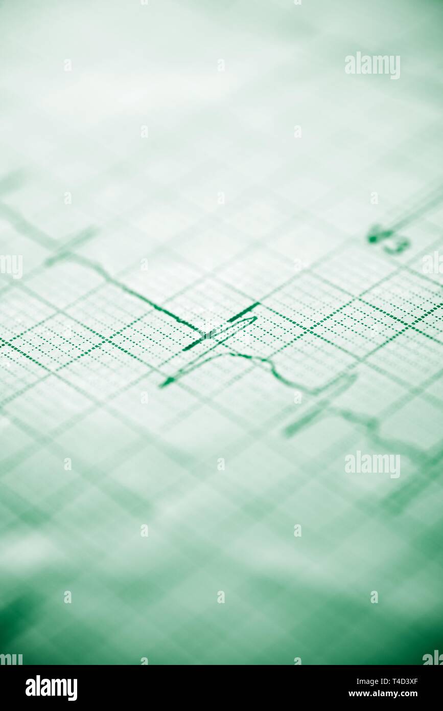 Close up of an electrocardiogram in paper form Stock Photo - Alamy