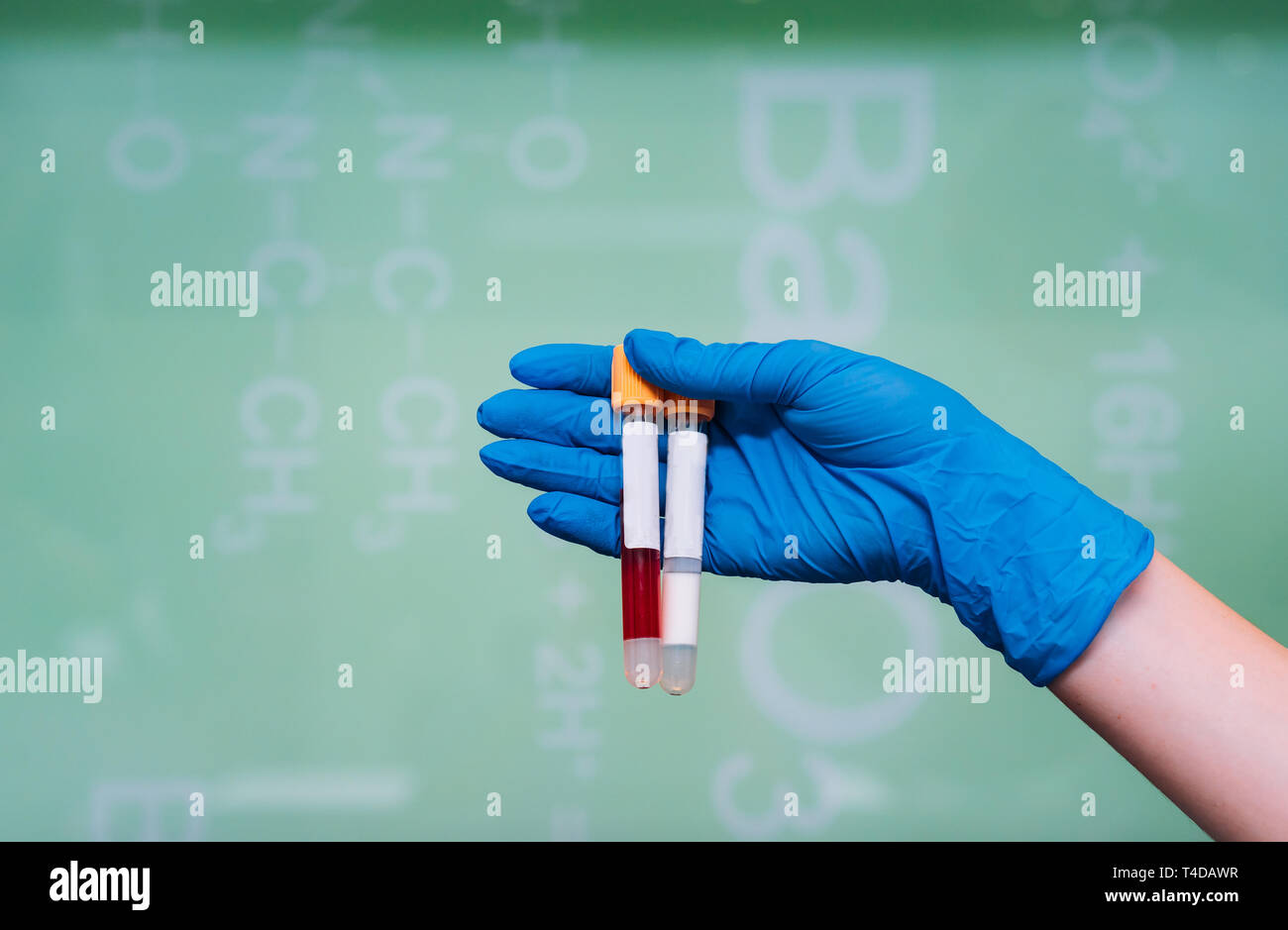 A rubber-gloved hand holds two test tube with the drug Stock Photo - Alamy