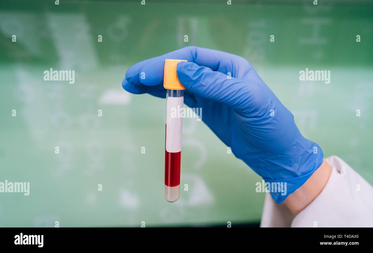 Gloved hands hold test hi-res stock photography and images - Alamy
