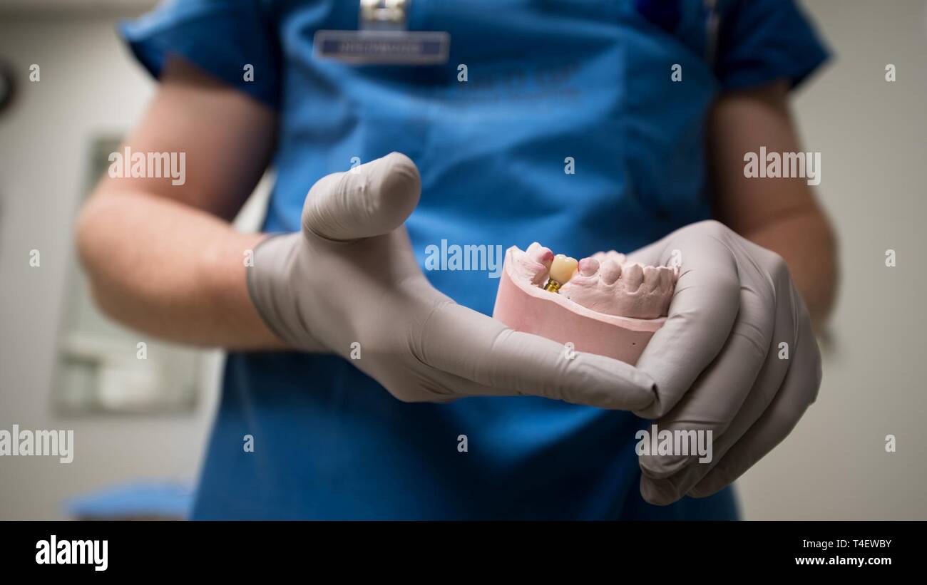 Mandibular second molar hi-res stock photography and images - Alamy
