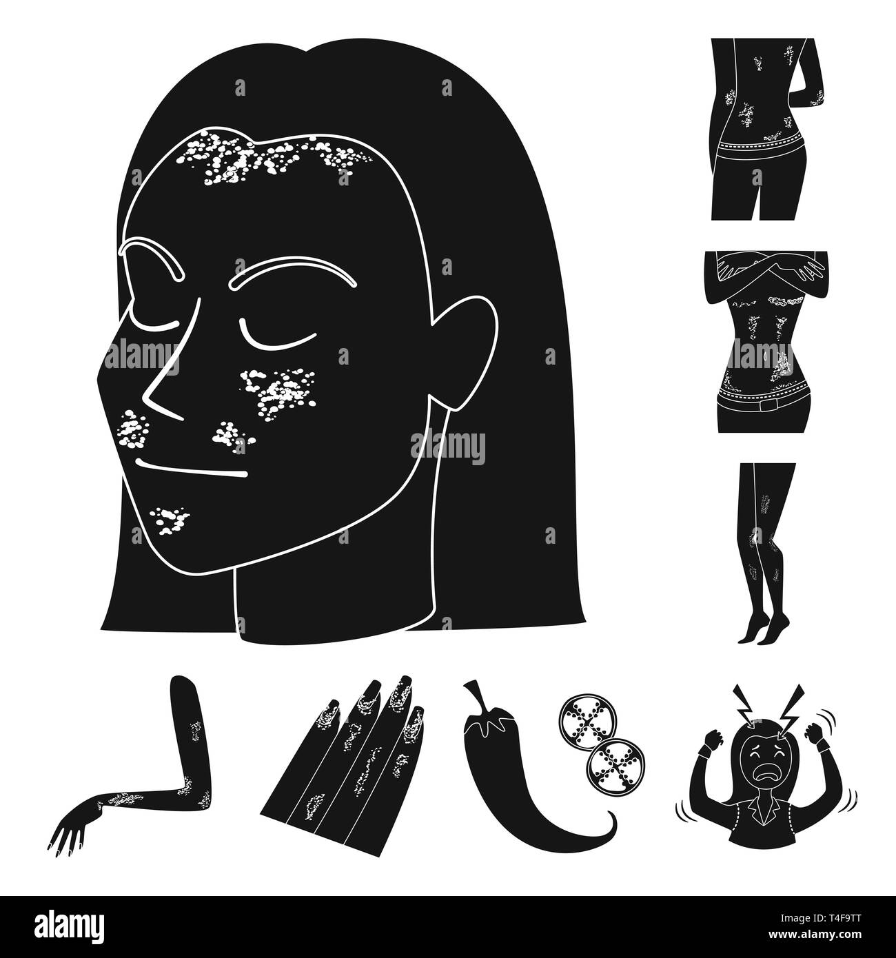 Rash skin hand woman Black and White Stock Photos & Images - Alamy