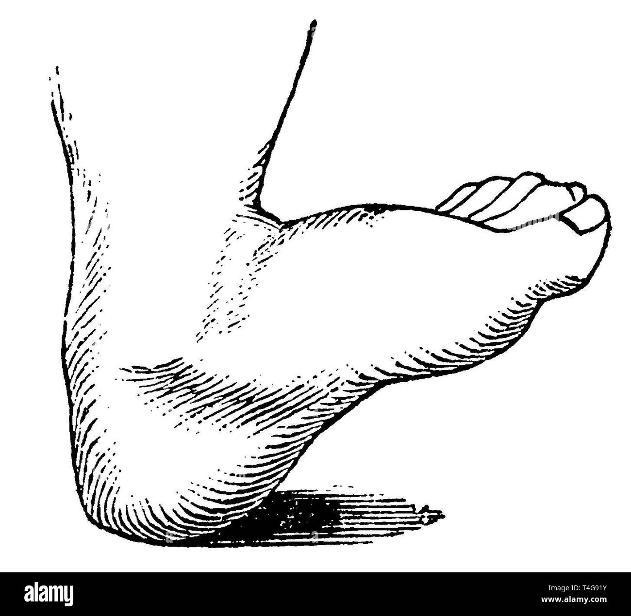 Hook leg hi-res stock photography and images - Alamy