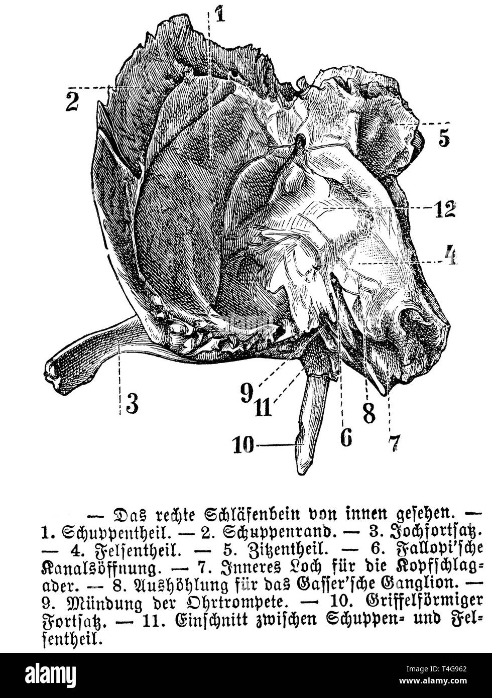 Temporal bone anatomy Black and White Stock Photos & Images - Alamy