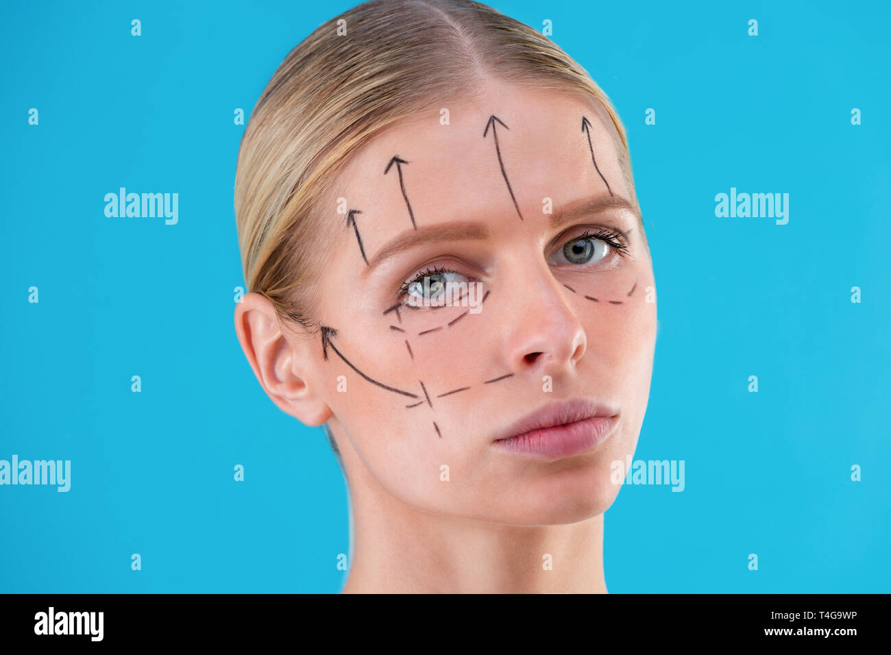 Beautician Draw Correction Lines On Woman Face Before Plastic Surgery Beautician Draw Correction Lines On Woman Face Before Plastic Surgery
