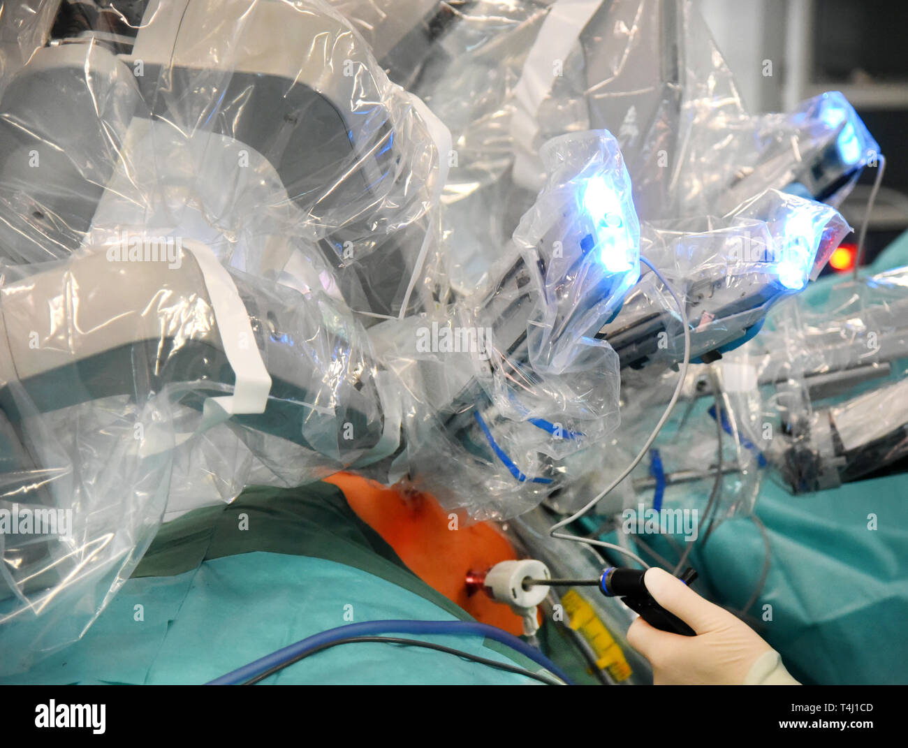 Robot da vinci urology hi-res stock photography and images - Alamy