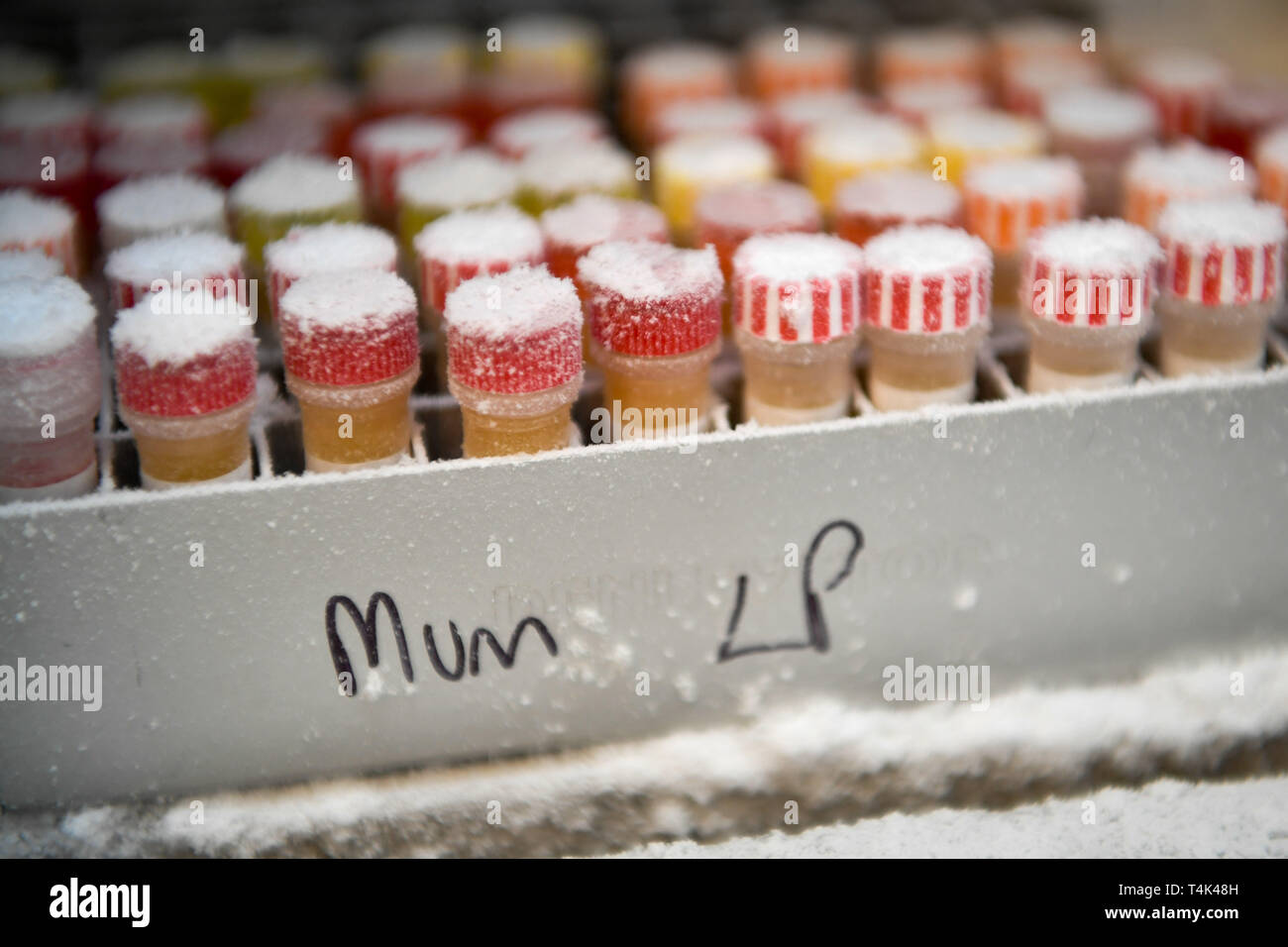 Medical samples and human tissues inside a deep freezer in a medical ...
