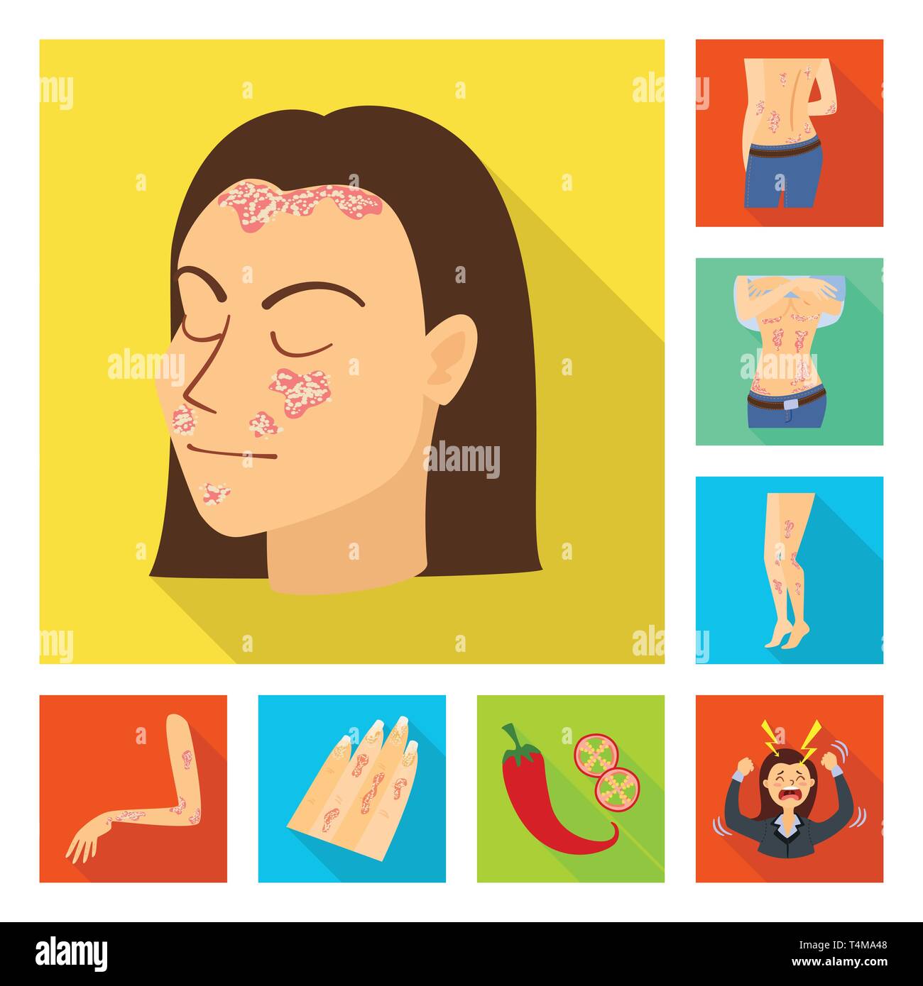 psoriasis,pepper,stress,skin,body,dermatitis,chili,shock,girl,allergy ...