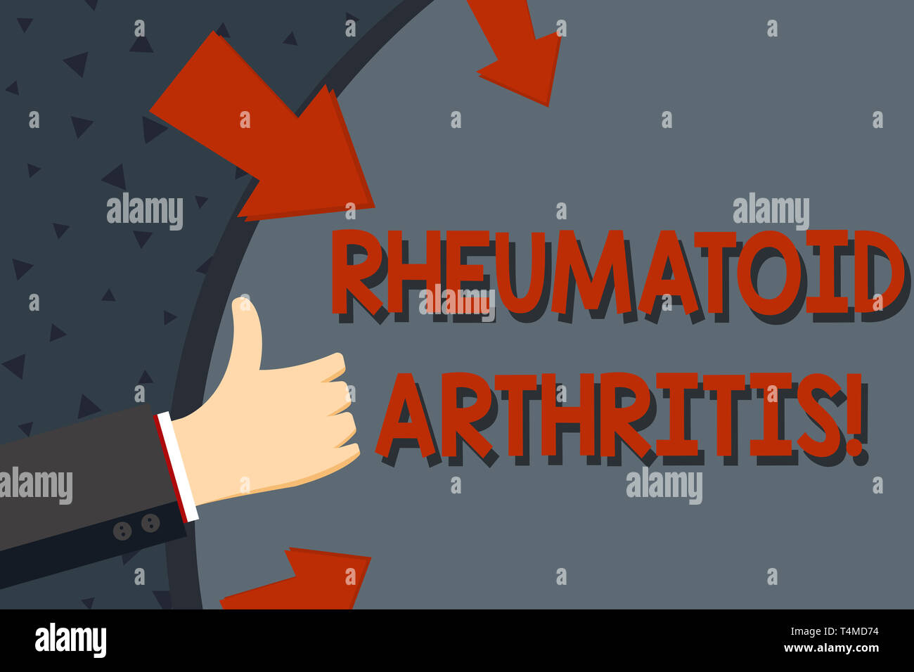 Text sign showing Rheumatoid Arthritis. Business photo text chronic ...
