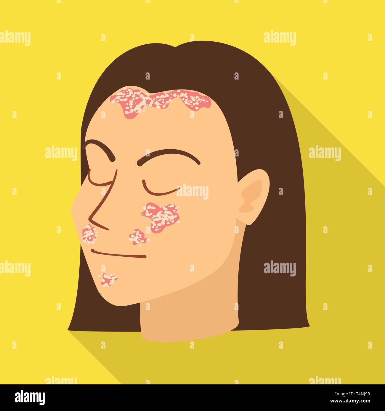 Isolated object of psoriasis and skin symbol. Set of psoriasis and ...