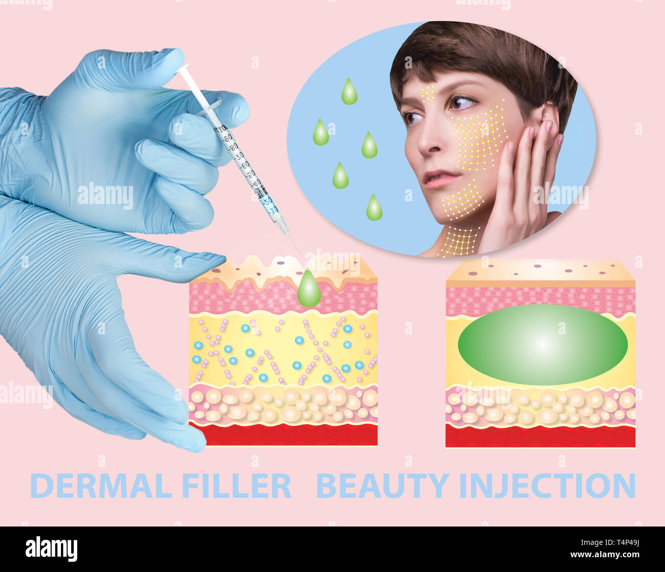 Cosmetic or dermal fillers. Young female with clean fresh skin ...