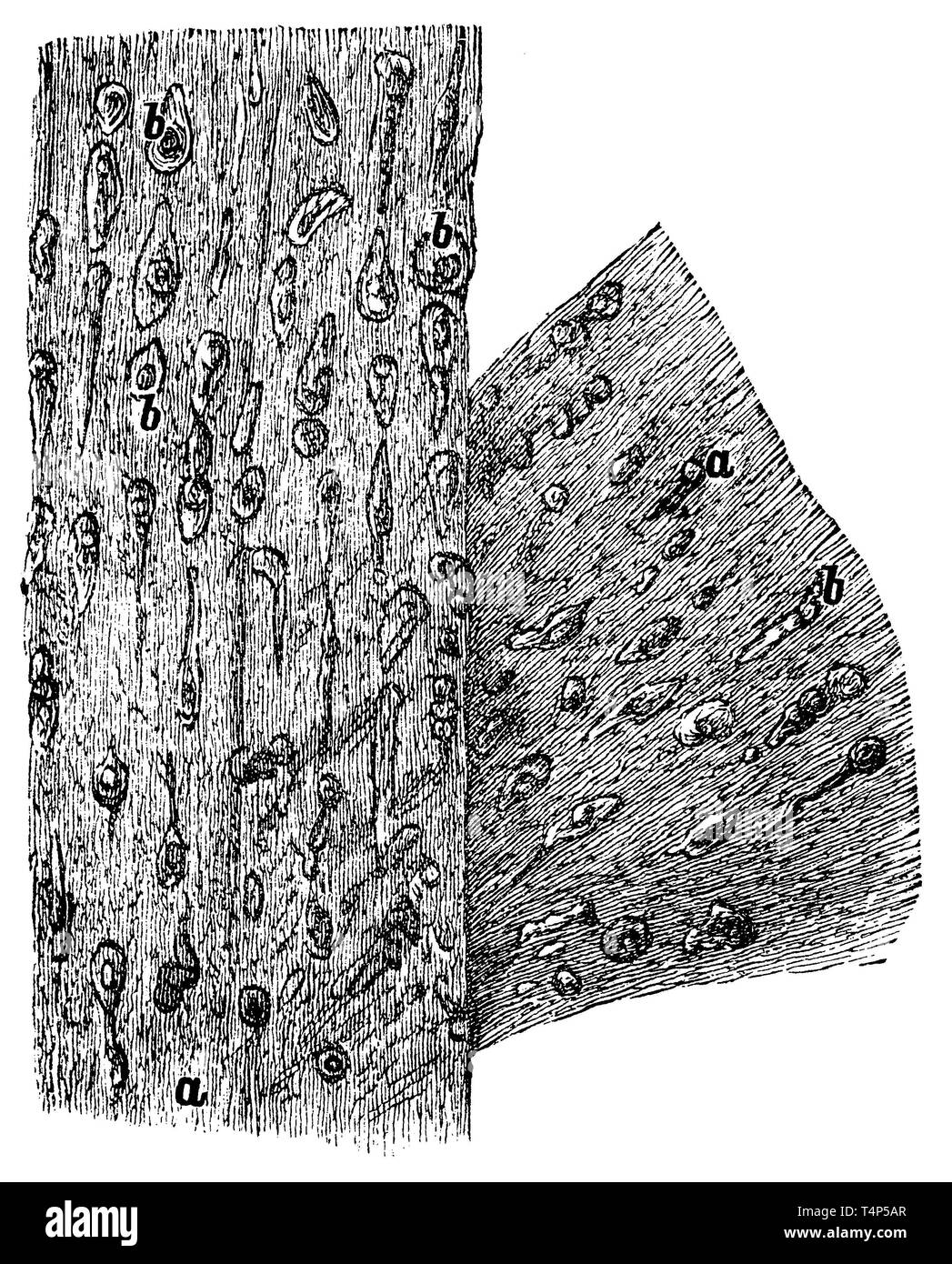 Fibrocartilage Drawing