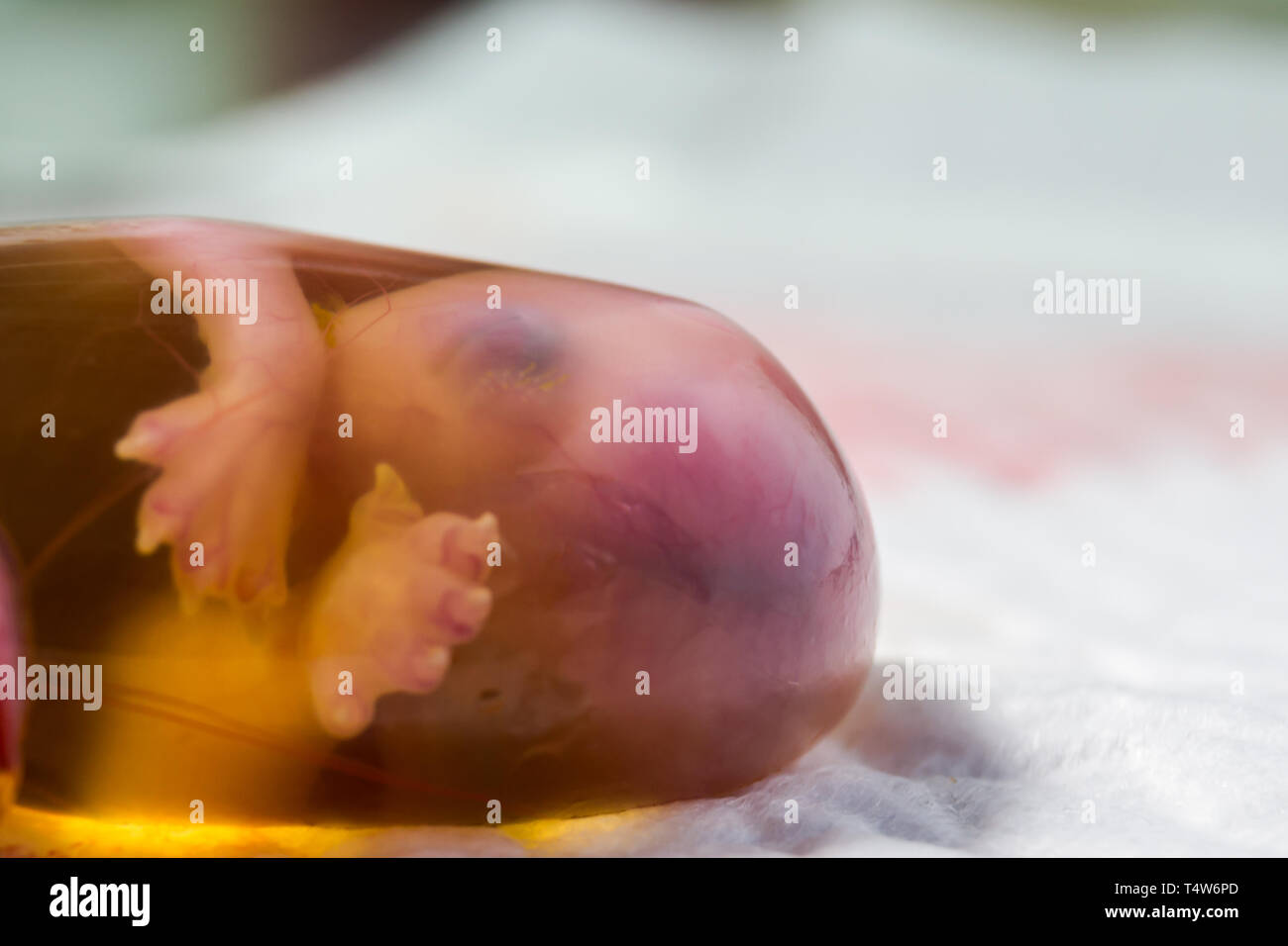 Amniotic sac hi-res stock photography and images - Alamy