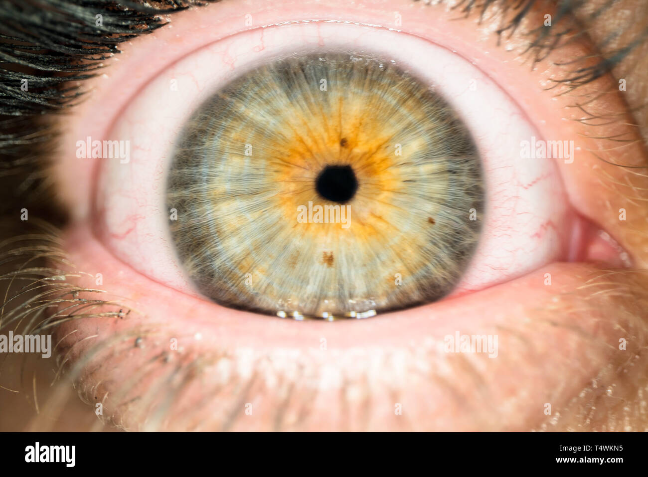 Macro shot of woman eyeball with small pupil. Close up of female eye ...
