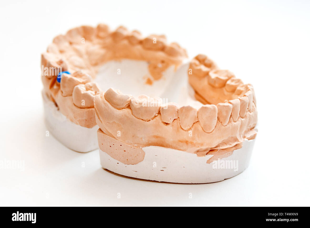 Plaster Cast of jaws. Dental casting gypsum model human Jaws in ...