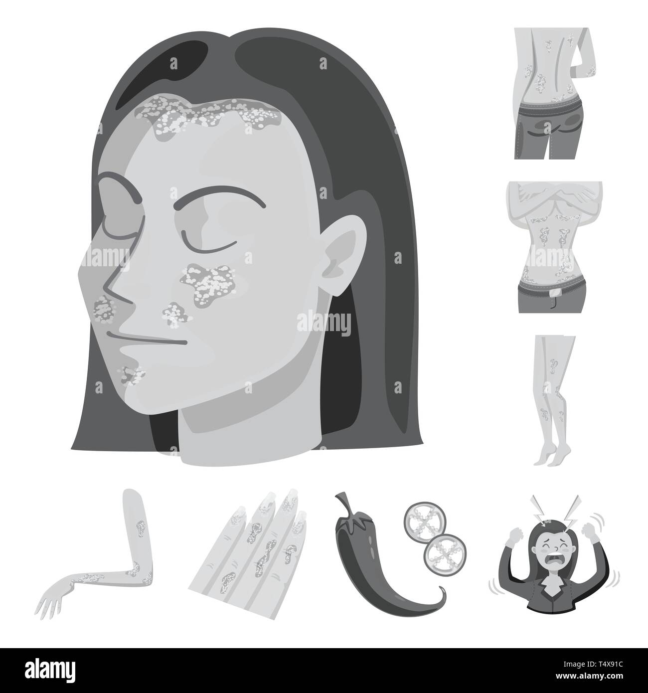 Woman Psoriasis Back Stock Vector Images Alamy