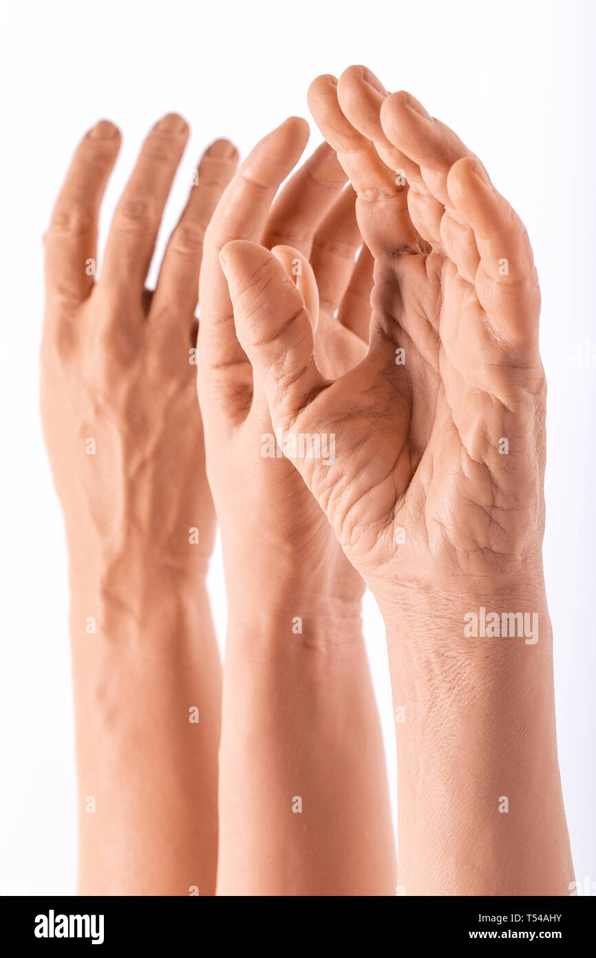 Silicone Implants In Hands