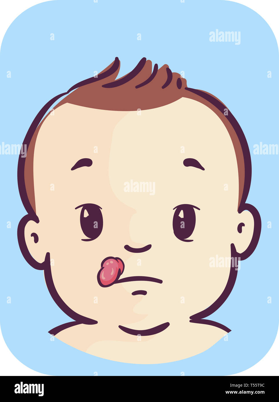 Illustration of a Baby Kid Boy with a Benign Skin Growth on His Face ...