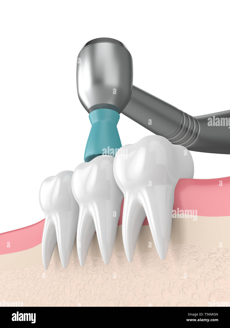 3d render of teeth with dental handpiece and polishing brush. Dental ...
