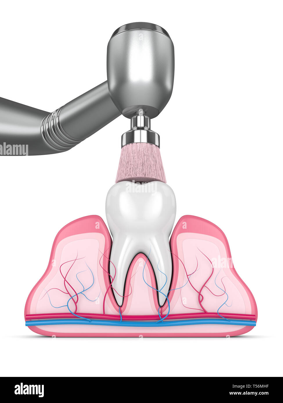 3d render of tooth with dental handpiece and polishing brush. Dental ...