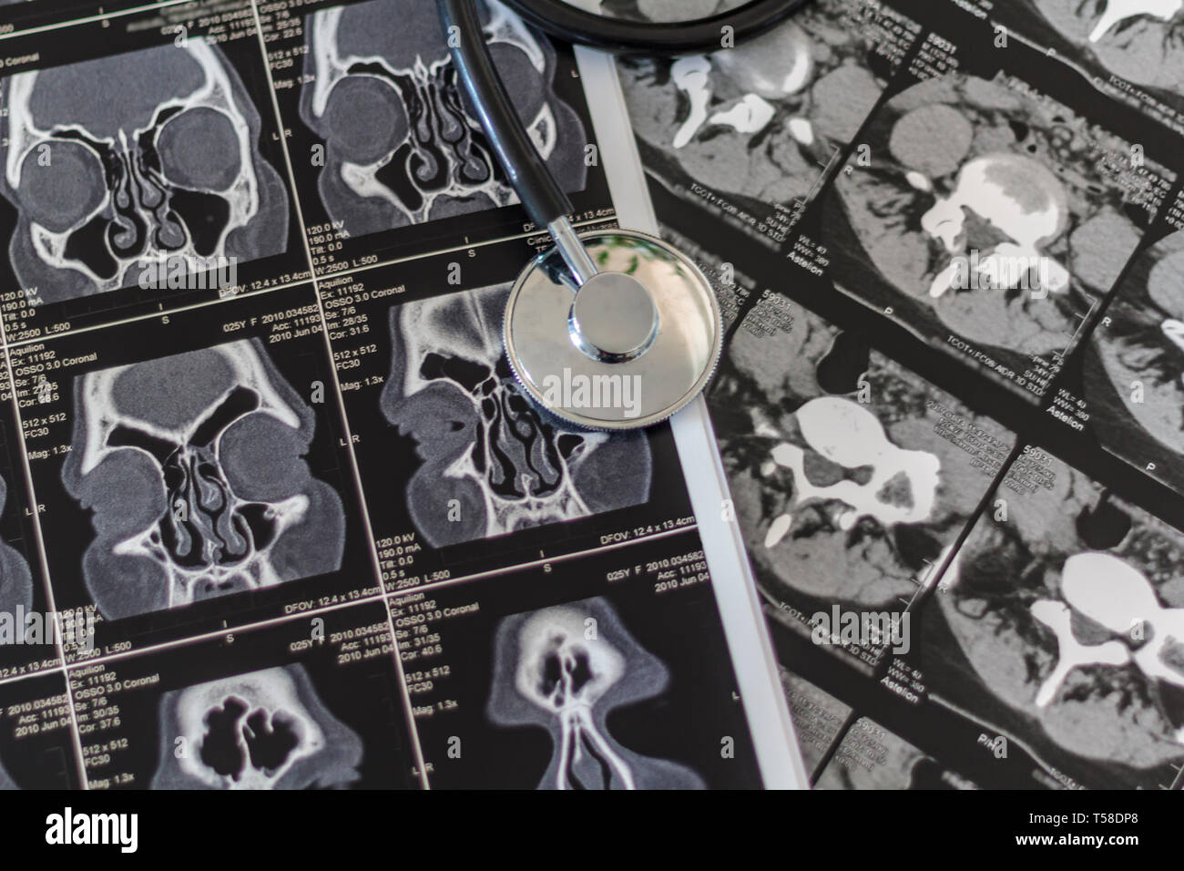 Computed Tomography High Resolution Stock Photography and Images - Alamy