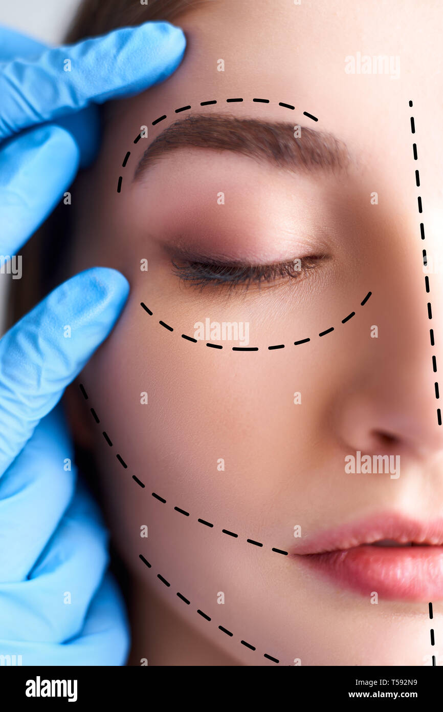 Beautiful young woman with perforation lines on her face before plastic ...