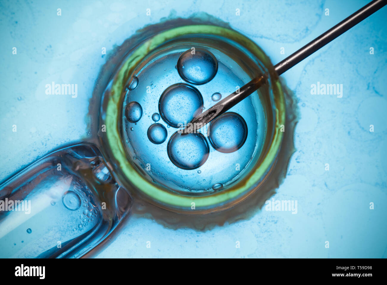Ivf hi-res stock photography and images - Alamy