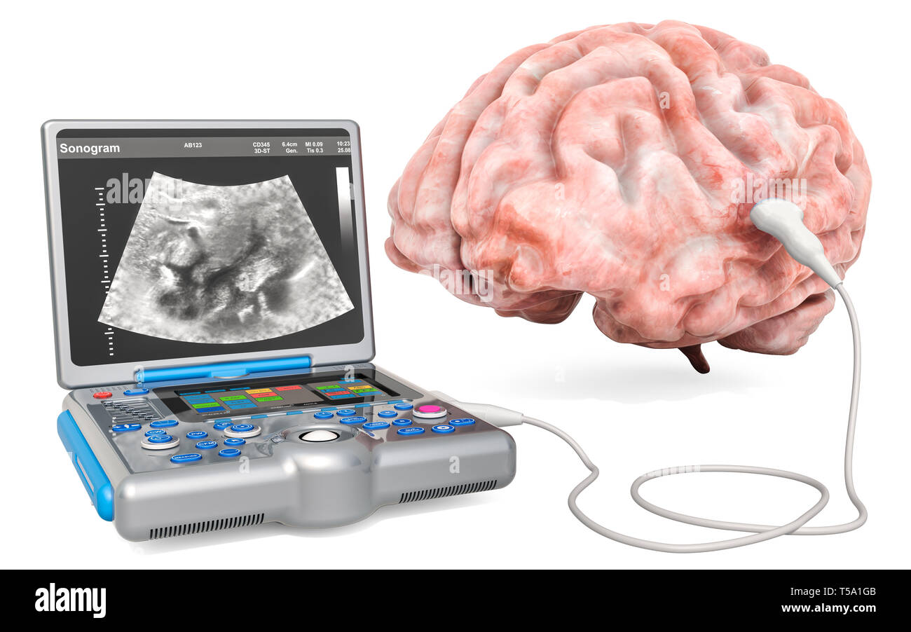 Brain Ultrasound concept. Human brain with medical ultrasound ...