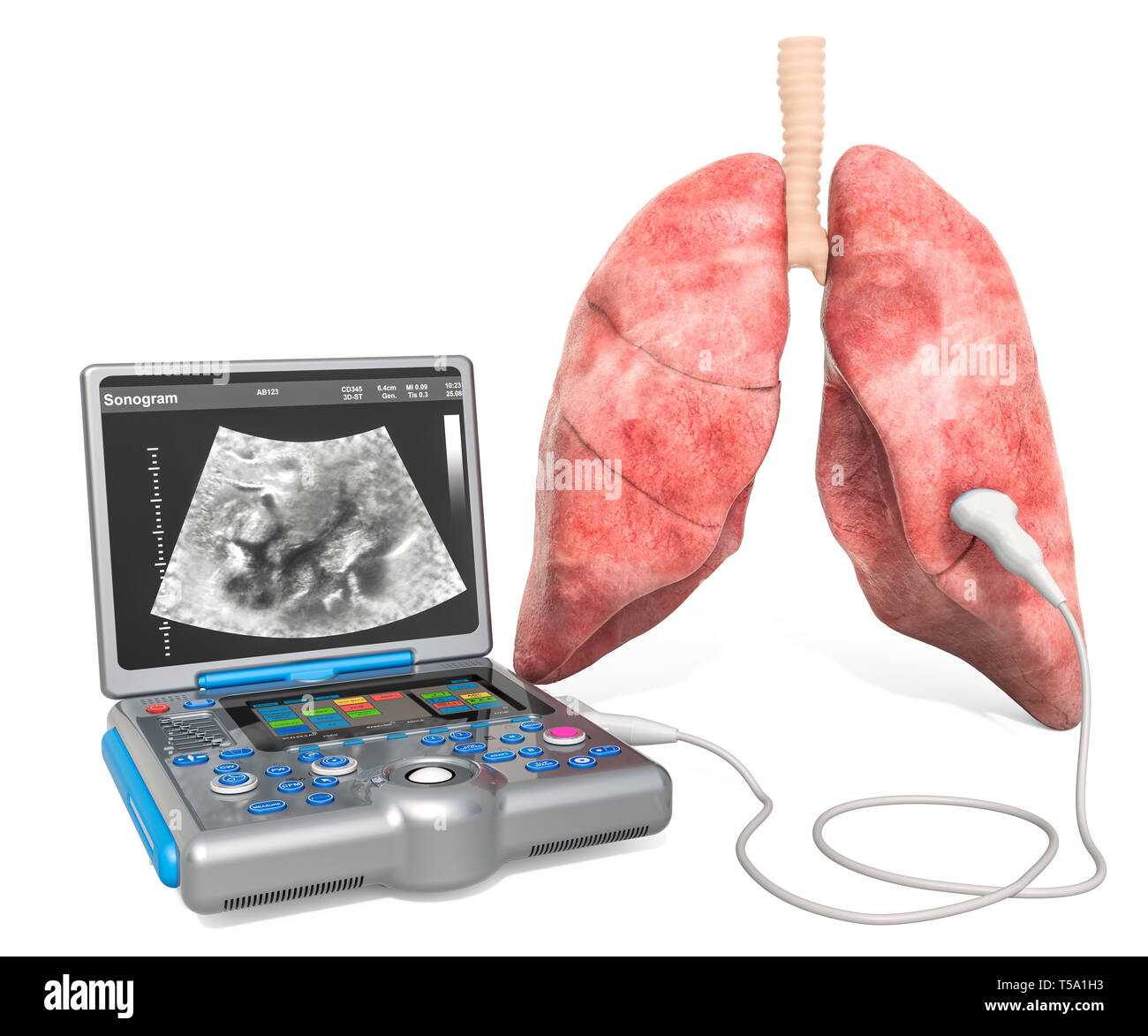 Lung ultrasound concept human hi-res stock photography and images - Alamy