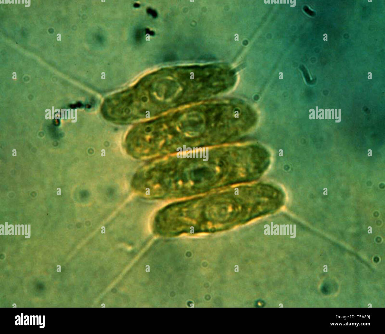 Scenedesmus hi-res stock photography and images - Alamy