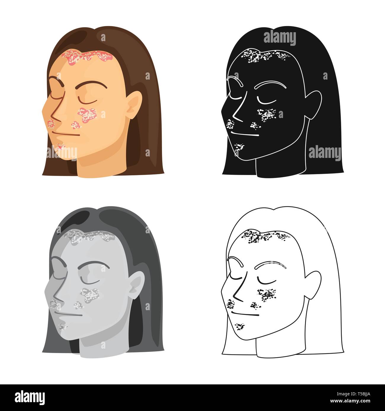 Vector illustration of psoriasis and skin sign. Set of psoriasis and ...