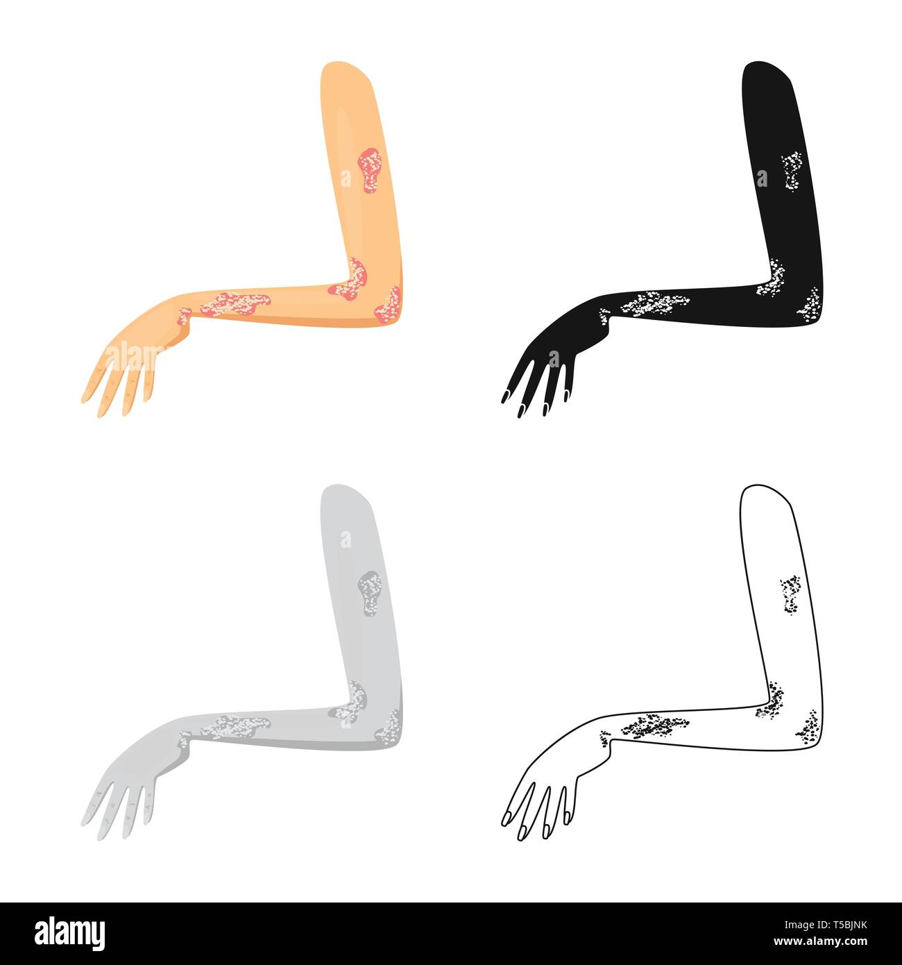 Vector Design Of Psoriasis And Dermatitis Icon Collection Of Psoriasis