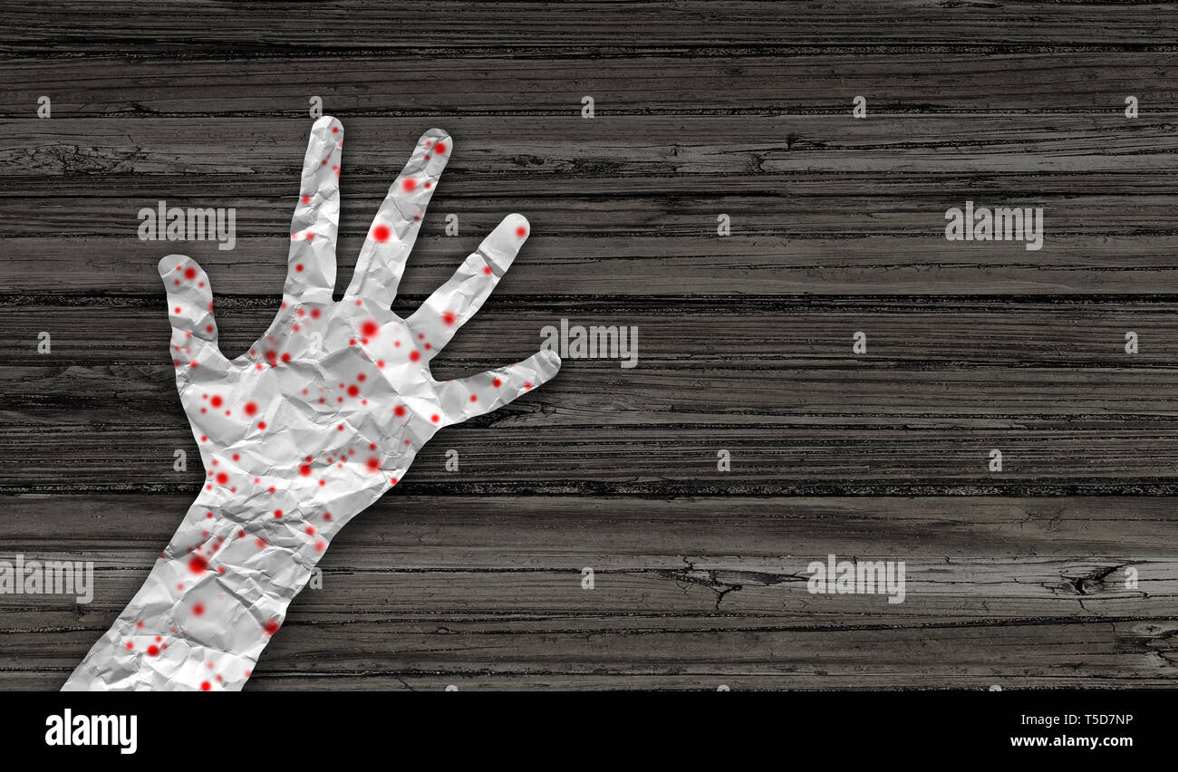 Measles disease symptoms and viral illness diagnosis as a contagious ...