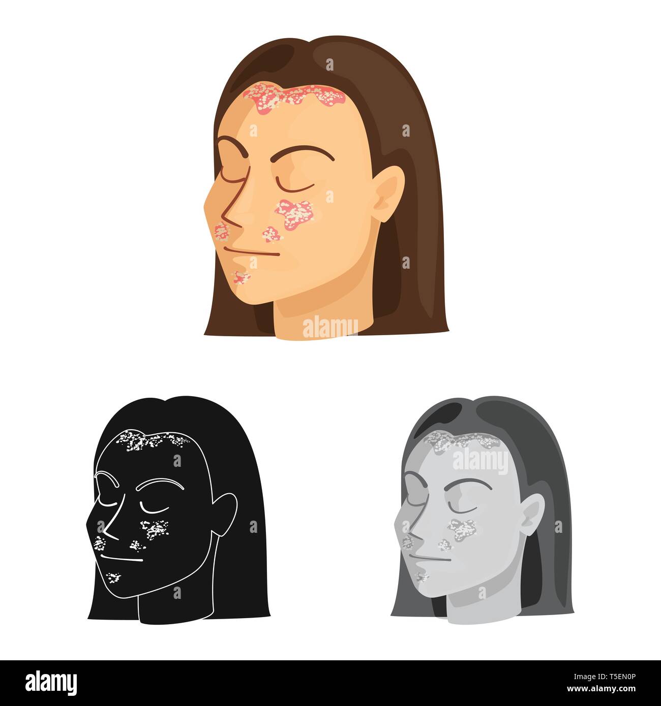 Vector illustration of psoriasis and skin symbol. Collection of ...