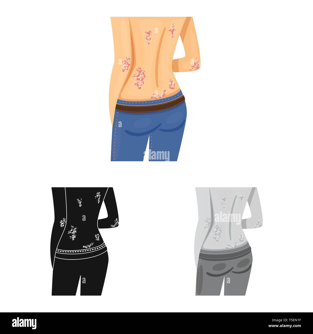 Vector illustration of psoriasis and skin icon. Set of psoriasis and ...