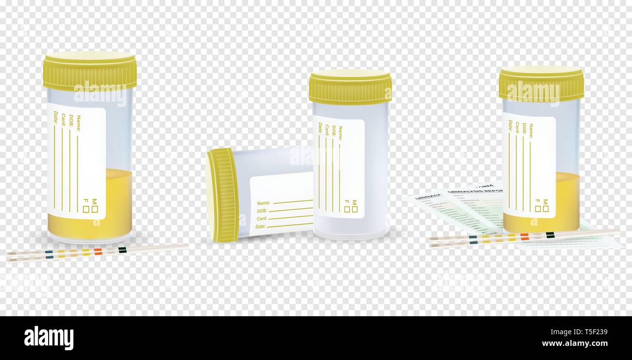 A sample of urine. Laboratory analysis of urine using test strips ...