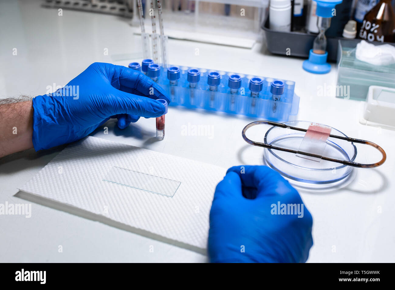scientist prepare blood sample for research on microscope. Placing ...