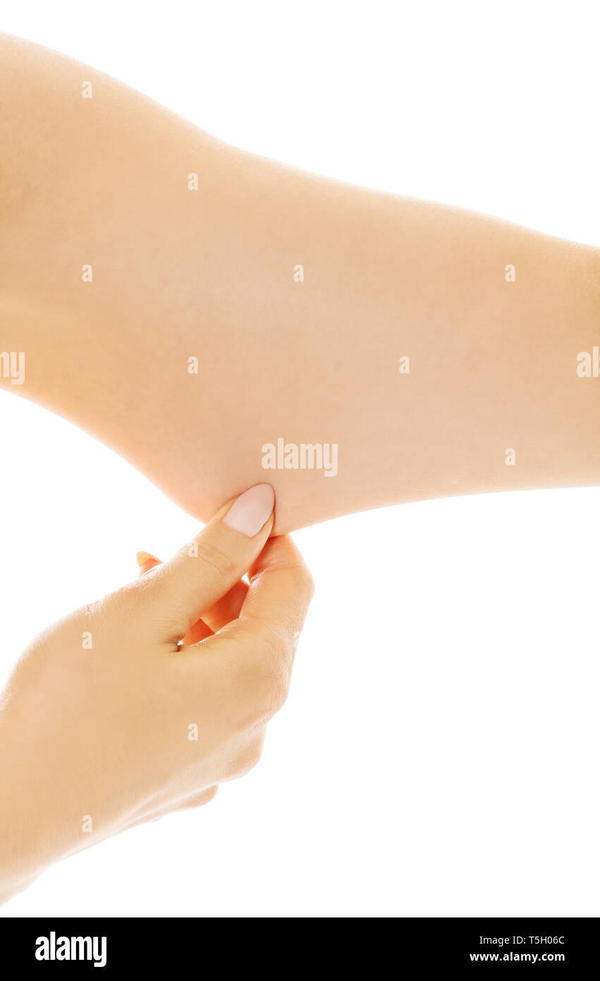 Hand pinch skin hi-res stock photography and images - Alamy