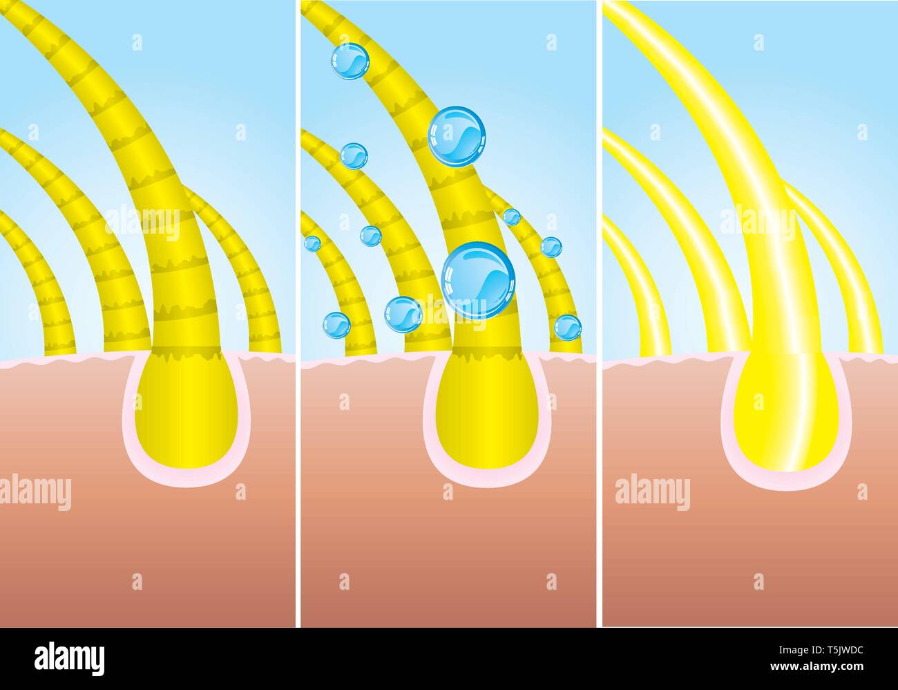 Illustration of three phase of hair cure, vector Stock Vector Image ...