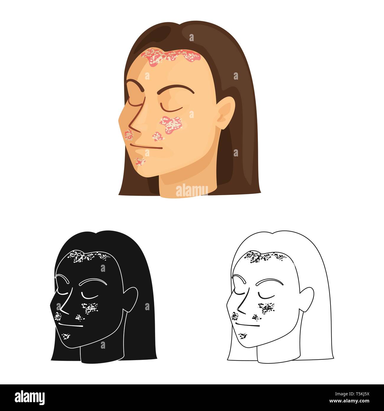 Vector design of psoriasis and skin logo. Set of psoriasis and allergy ...