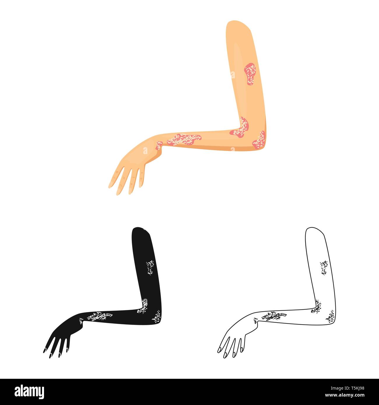 itch,sick,allergy,stress,hand,body,psoriasis,dermatitis,skin,rash ...