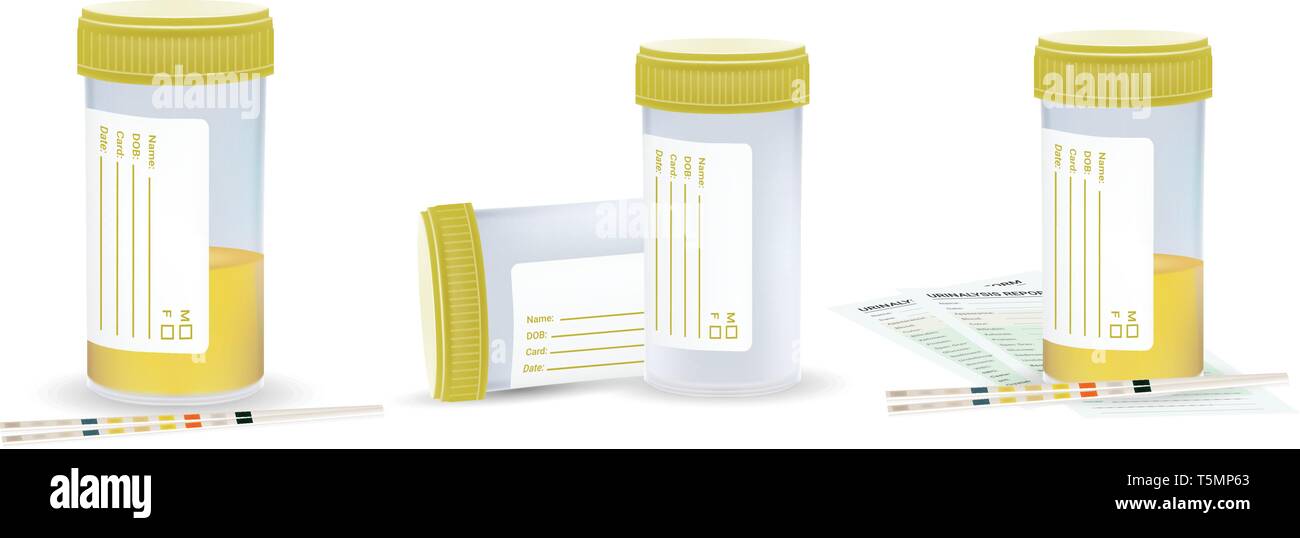 Urine sample set, full and empty containers. Vector illustration, eps ...