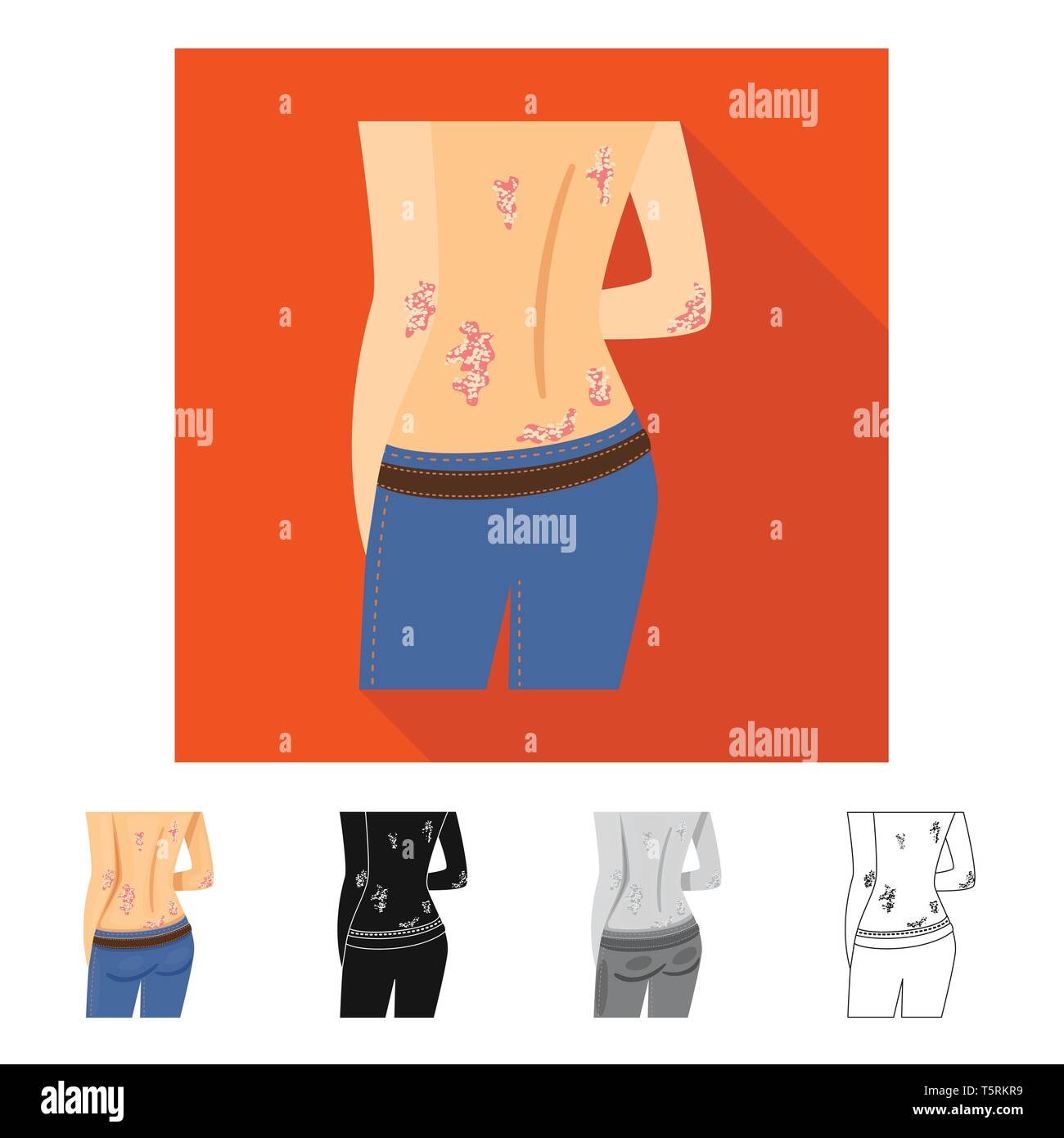 Skin rash back Cut Out Stock Images & Pictures - Alamy