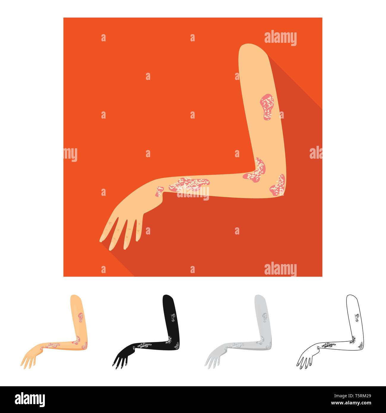 Vector illustration of psoriasis and dermatitis sign. Set of psoriasis ...