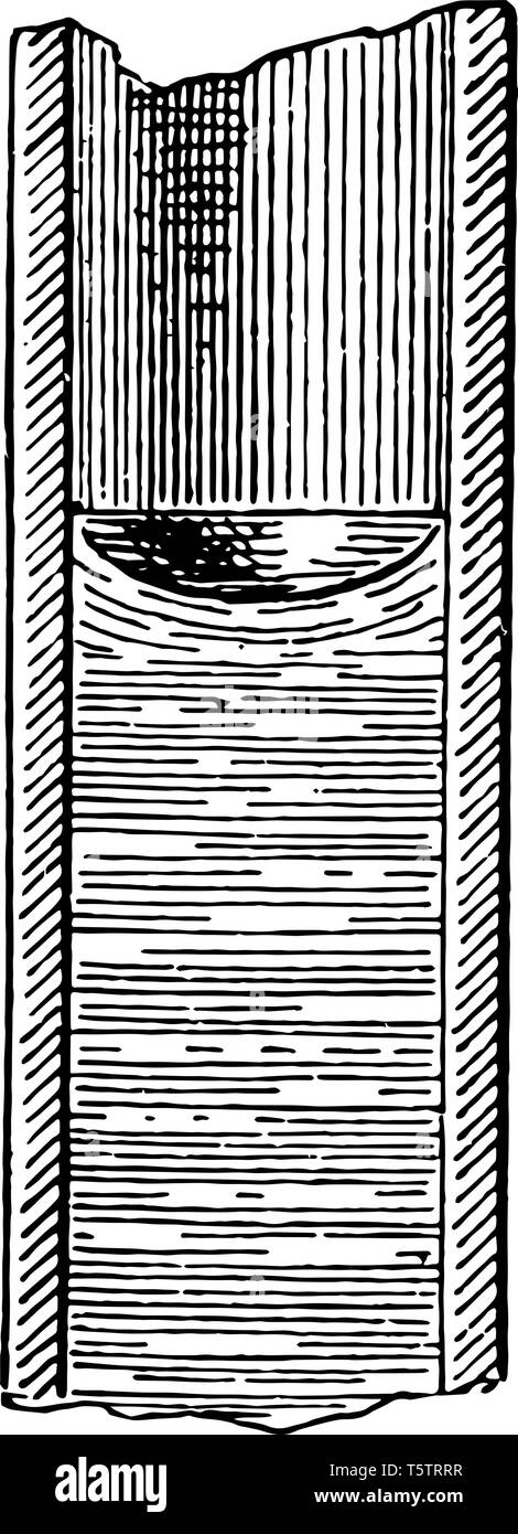 This diagram represents Concave of Meniscus vintage line drawing or ...