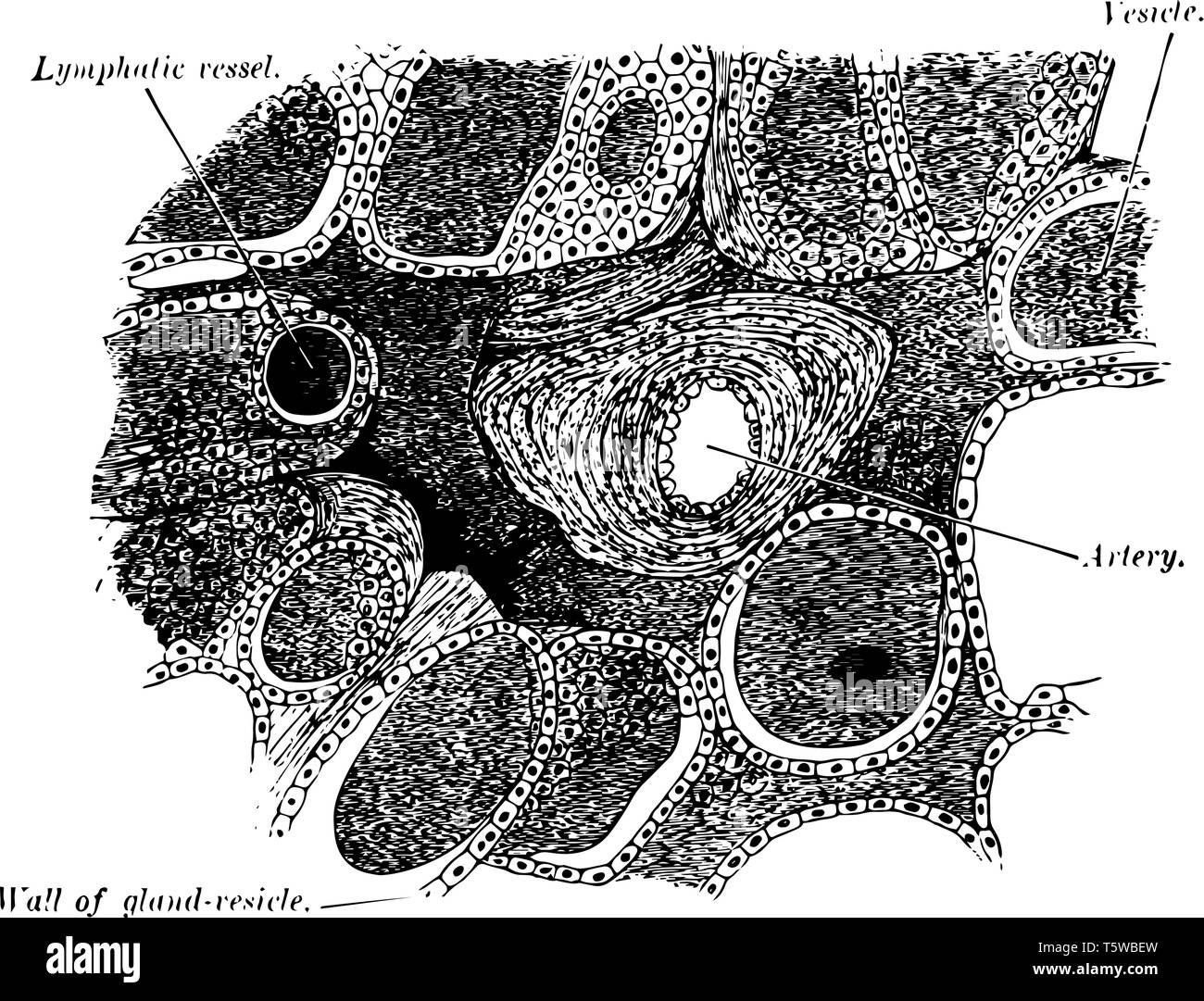 Thyroid gland Black and White Stock Photos & Images - Alamy