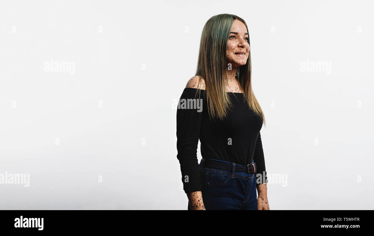 Freckles all over face hi-res stock photography and images - Alamy