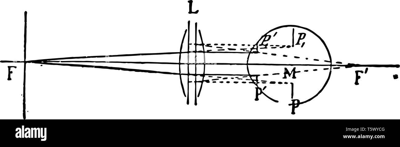 This illustration represents Optical Position and Size of Image Through ...