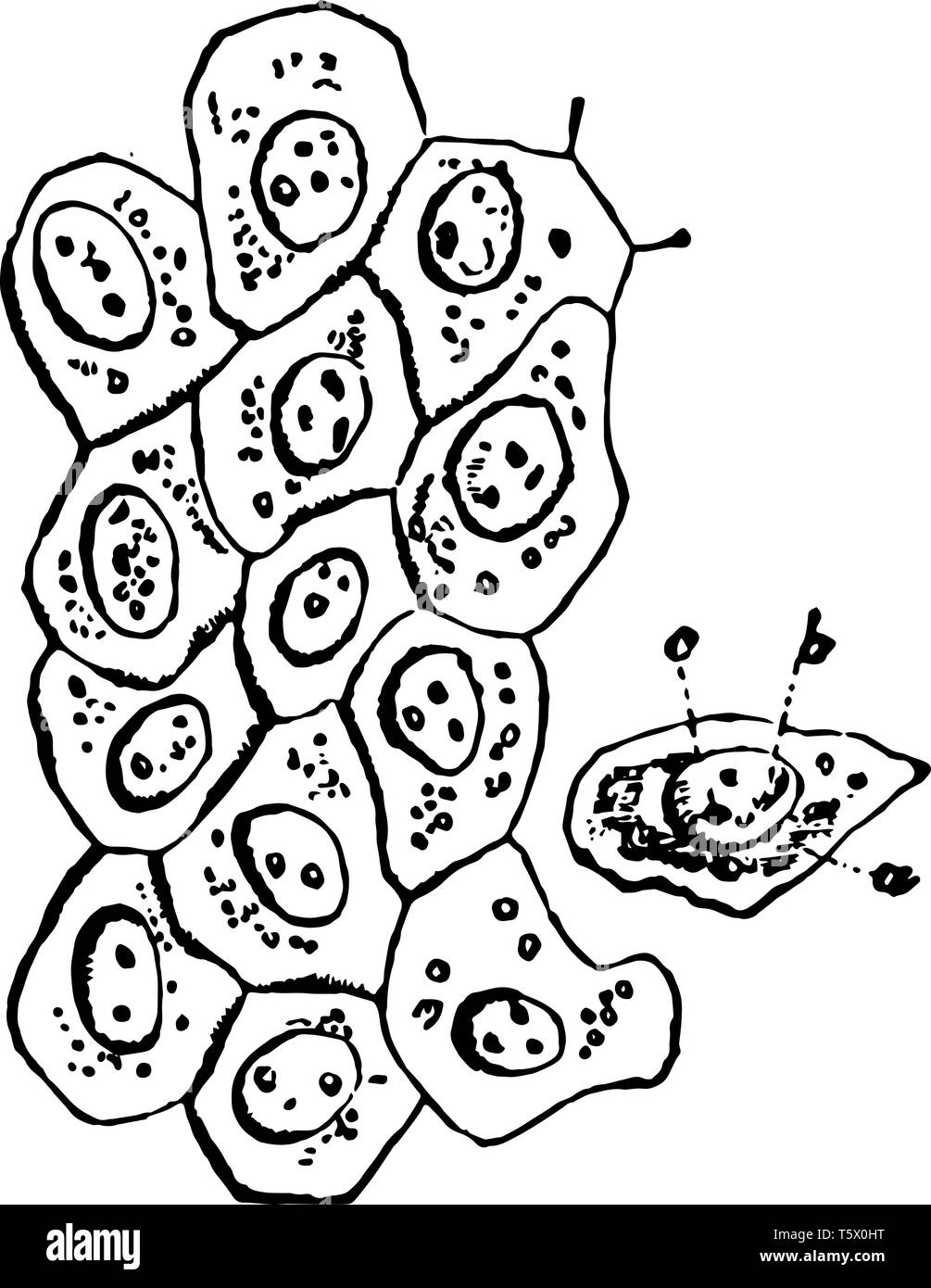 Flat cells from the surface of the lining membrane of the abdomen ...