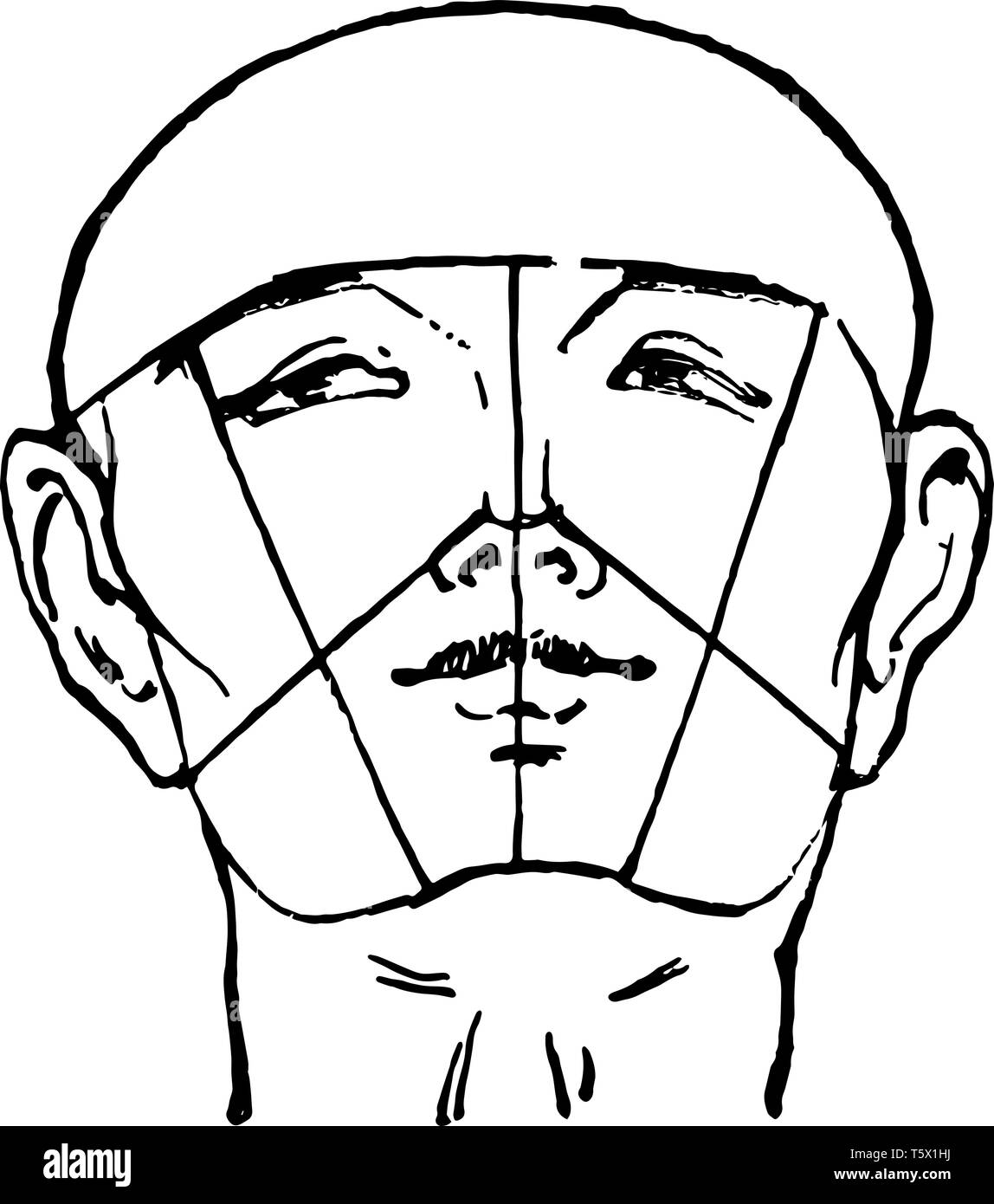 Male Face shown with a bald head in this picture vintage line drawing ...