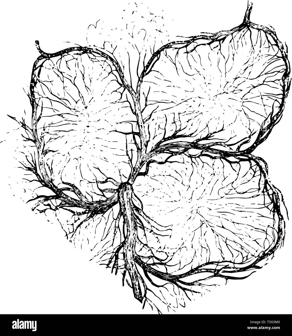 Peyer Glands occur chiefly but not exclusively in the small intestine ...